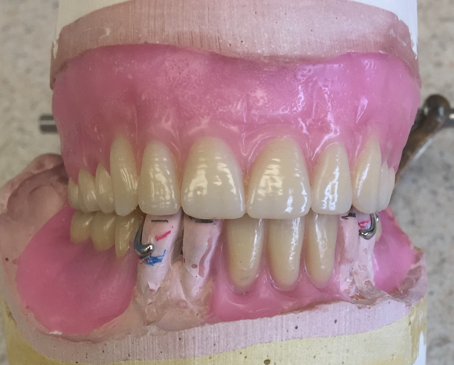 About – Burlington Dental Laboratory, Inc